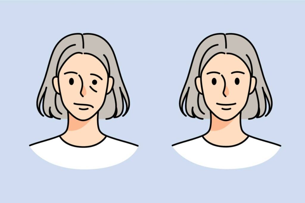 Is Bell Palsy Contagious: Myths About the Condition | Clarity Eye and Face